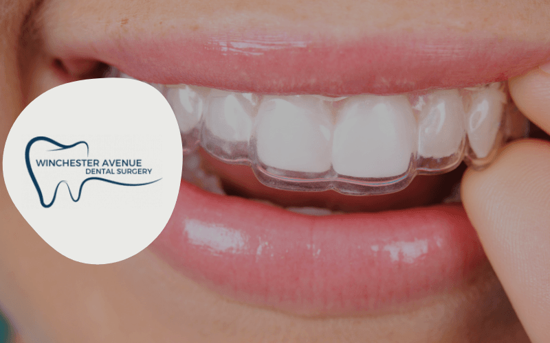Can a Dental Retainer Straighten Teeth? Expert Insights