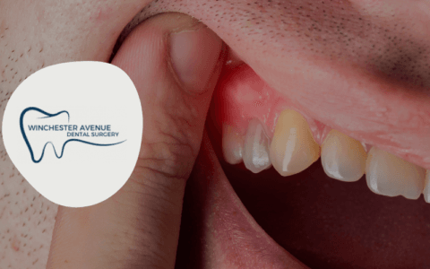 What is a Gum Cyst? Causes, Treatment, Prevention & FAQs